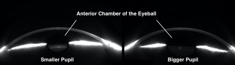 Rodenstock Progressive Lenses [A Decision Guide]