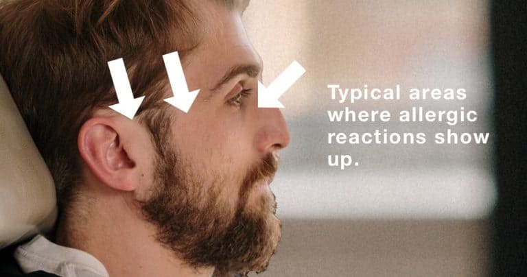 Can You Be Allergic To Glasses Frames?