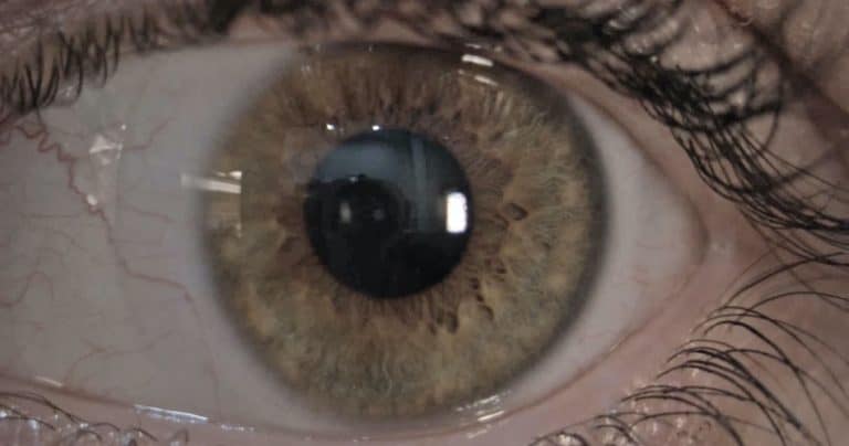 14 Reasons Why Vision is Better with Contacts Than Glasses