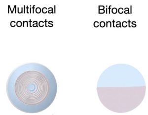 Single Vision vs. Bifocal Lenses Explained (With Examples)