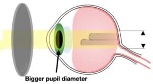 Best Glasses for Eye Floaters – How To Minimize Them